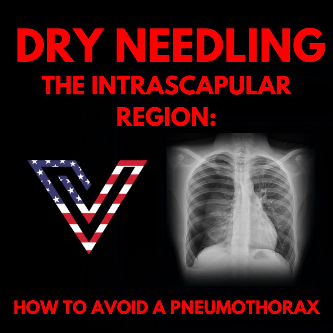Dry Needling & Pneumothorax: Avoiding Risk in the Intrascapular Region ...