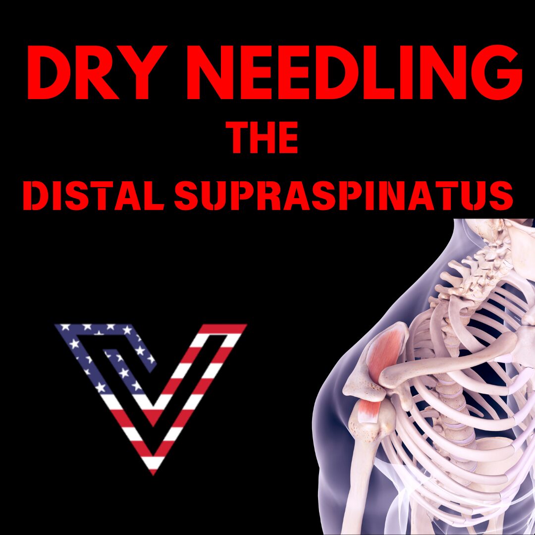 Dry Needling the Supraspinatus for Rotator Cuff Pain | Vertex PT ...